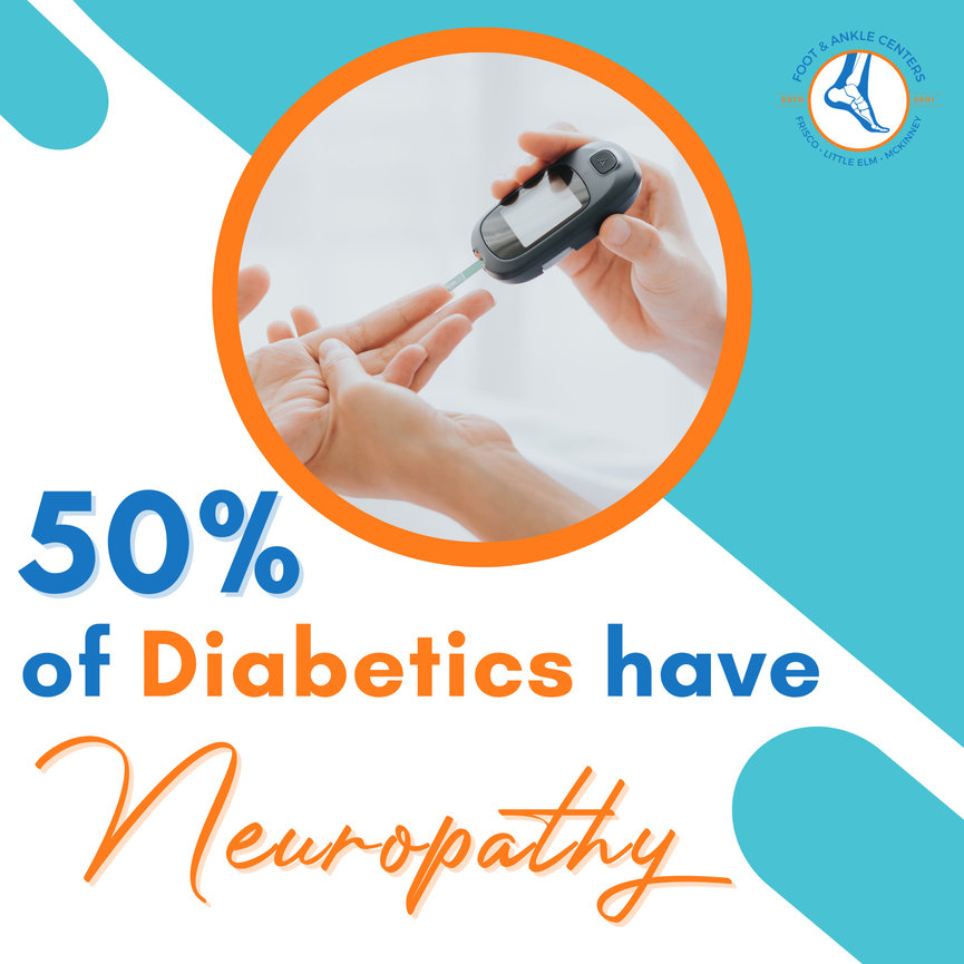 What Is Diabetic Neuropathy Foot Ankle Centers Of Frisco And Plano what-is-diabetic-neuropathy-foot-ankle-centers-of-frisco-and-plano